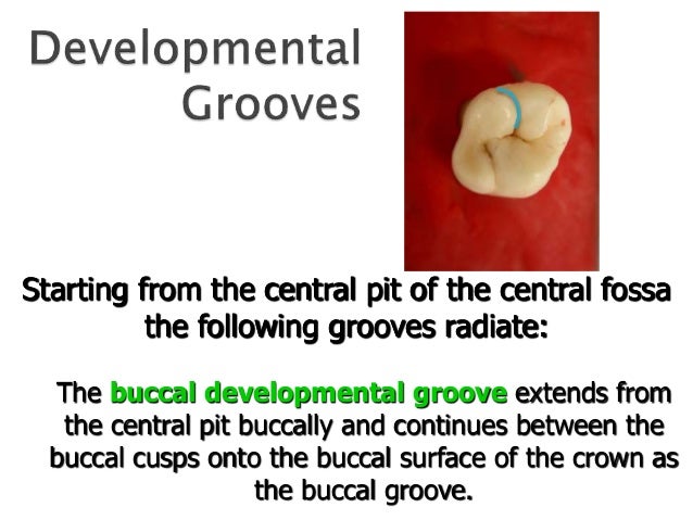Dental anatomy,max.first molar