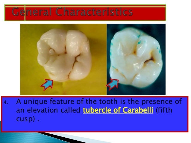 Dental anatomy,max.first molar