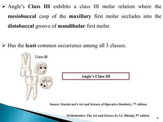 Clinical Significance of Dental Anatomy, Physiology and Occlusion | PPTX