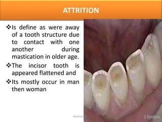 Dental Anatomy | PPTX