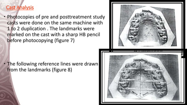 Dental and Skeletal changes after intraoral molar distalization with ...