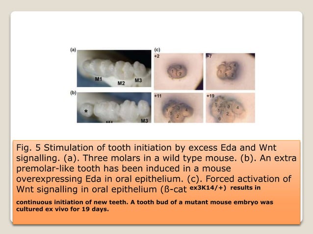 Dental anomalies and Genetics | PPTX | Dental Health | Diseases and ...