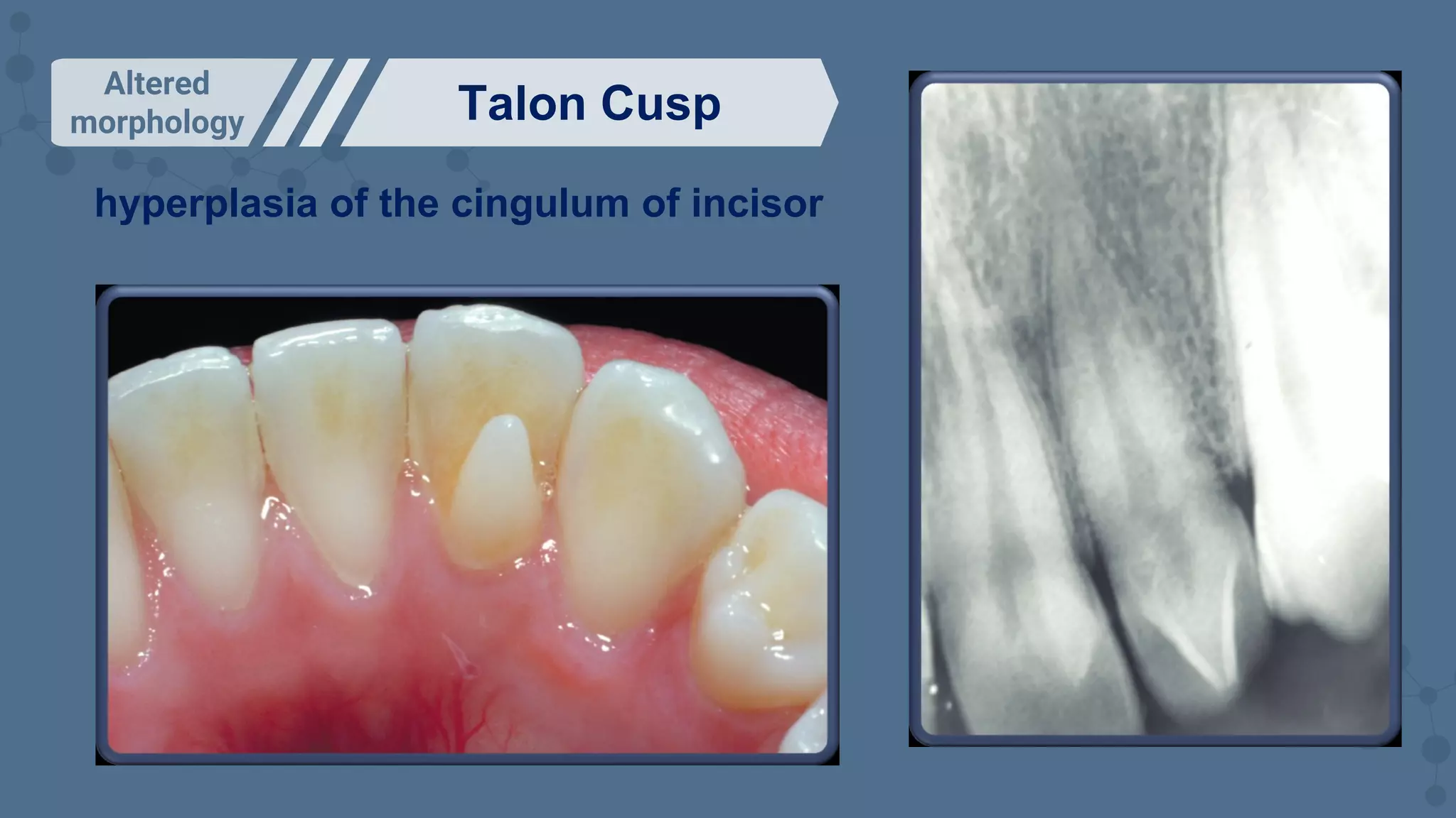 Dental anomalies | PDF