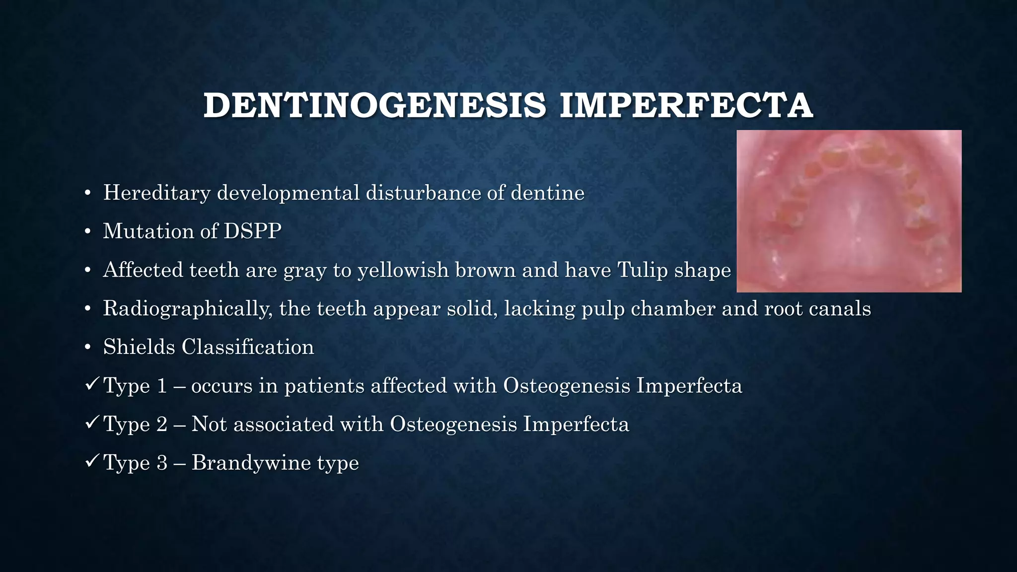 Dental anomalies and its prosthetic implications.pptx