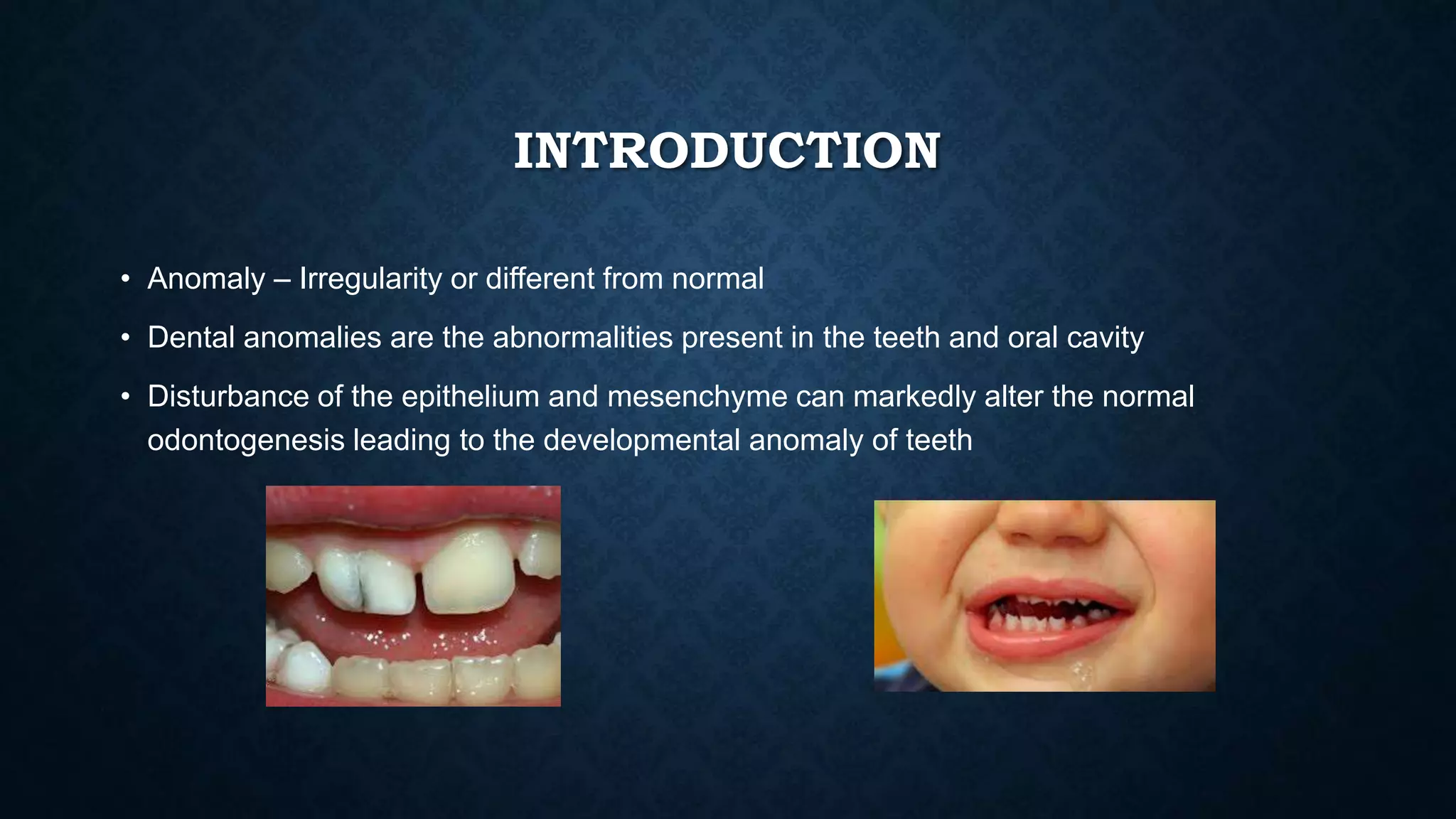 Dental anomalies and its prosthetic implications.pptx