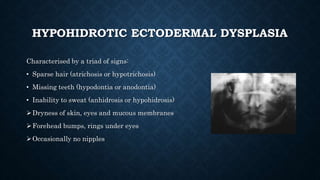 Dental anomalies and its prosthetic implications.pptx