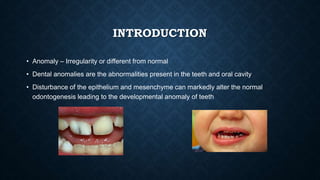 Dental anomalies and its prosthetic implications.pptx