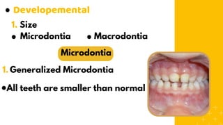 Dental Anomalies & Final Edition.pdf by Alsayed | PDF