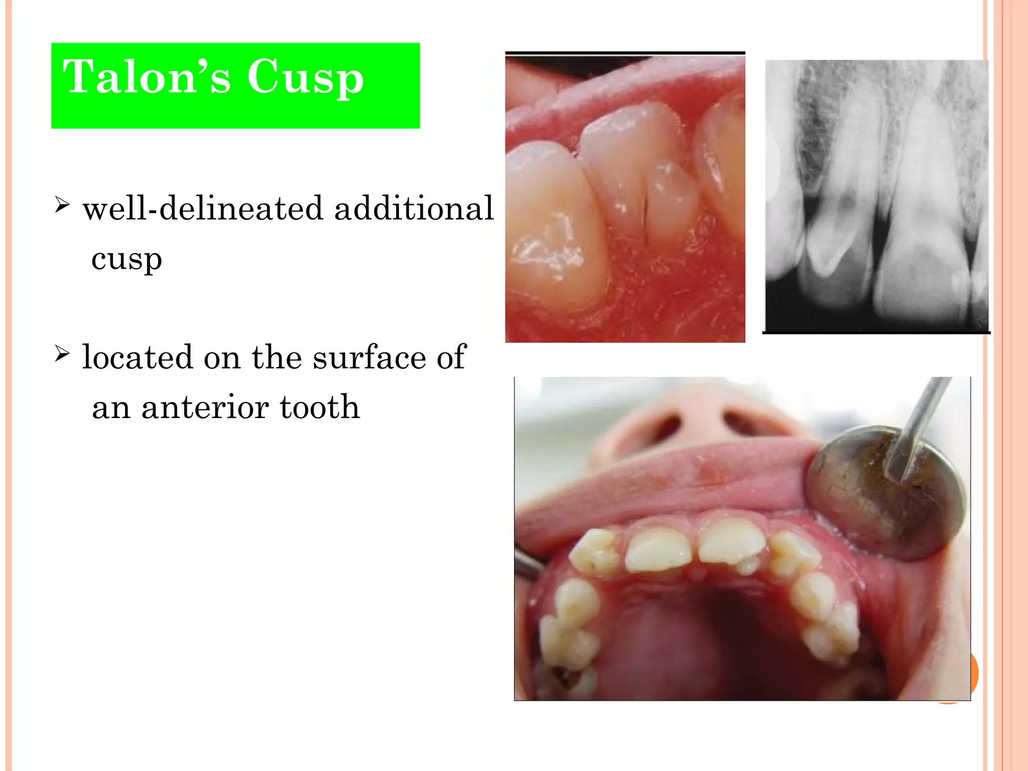 Dental anomaly | PPT
