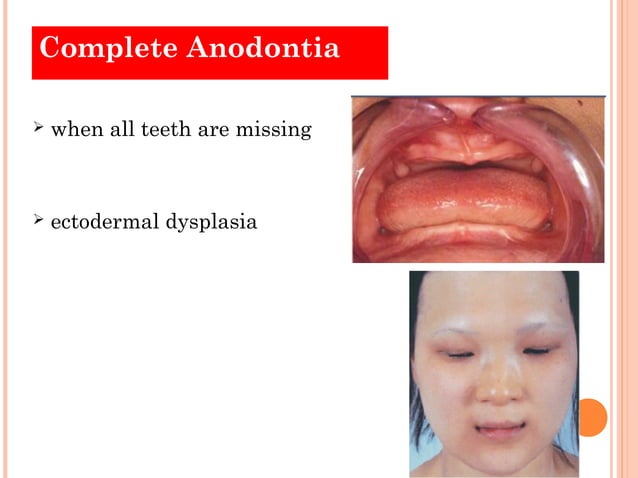 Dental anomaly | PPT