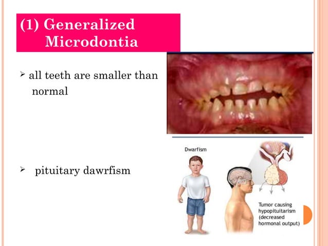 Dental anomaly | PPT