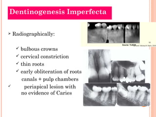 Dental anomaly | PPT