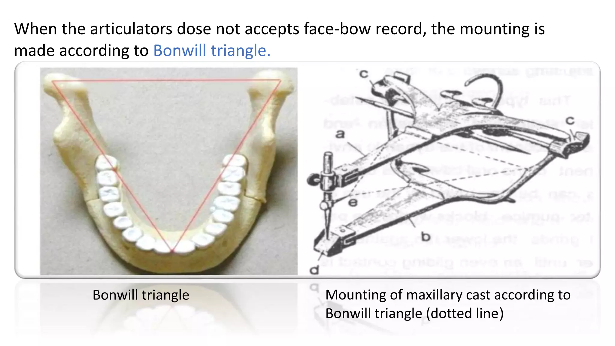 Dental articulator | PPTX