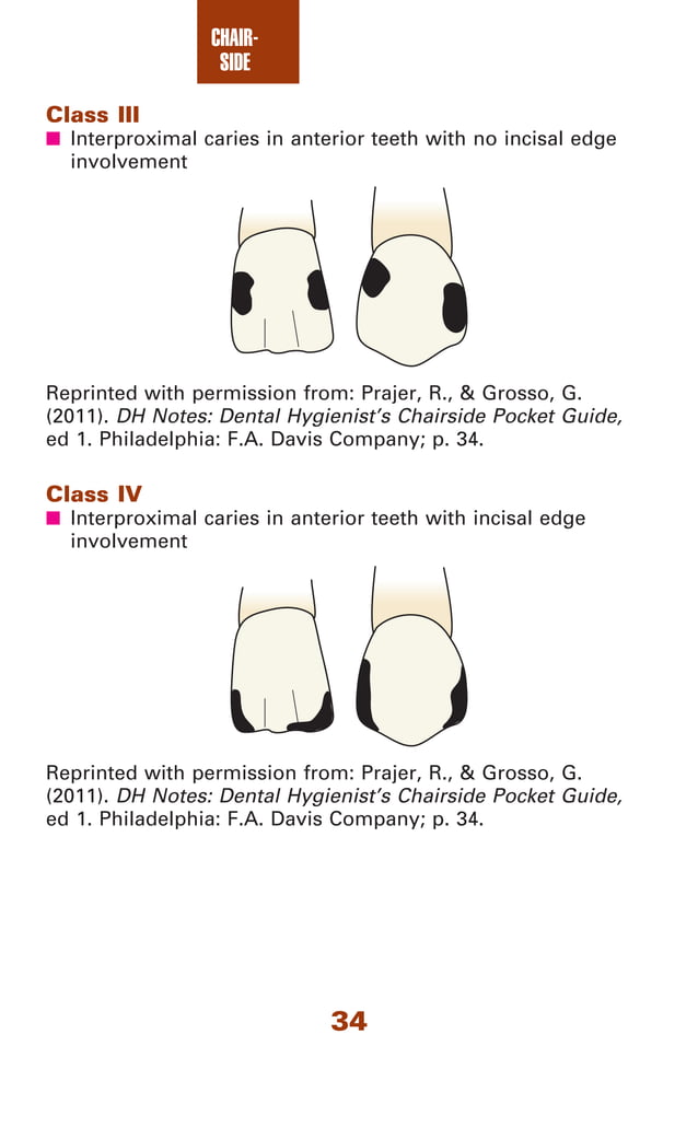 Dental assisting notes dental assistant's chairside pocket guide, 1 e ...