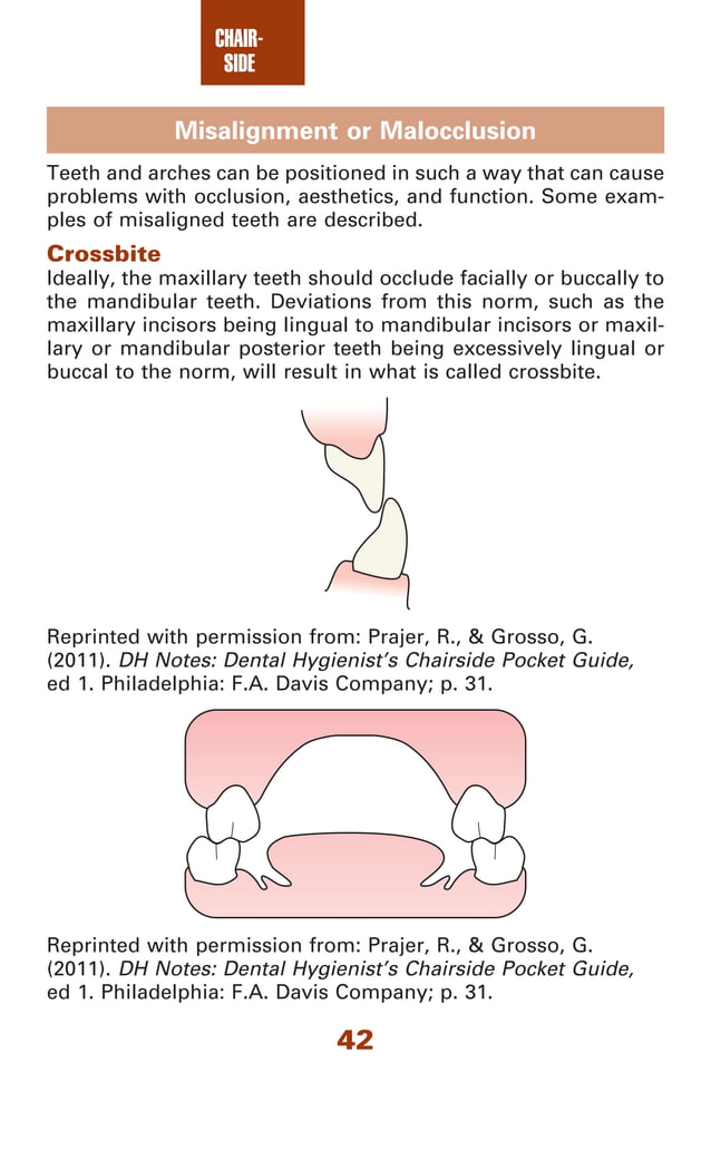 Dental assisting notes dental assistant's chairside pocket guide, 1 e ...