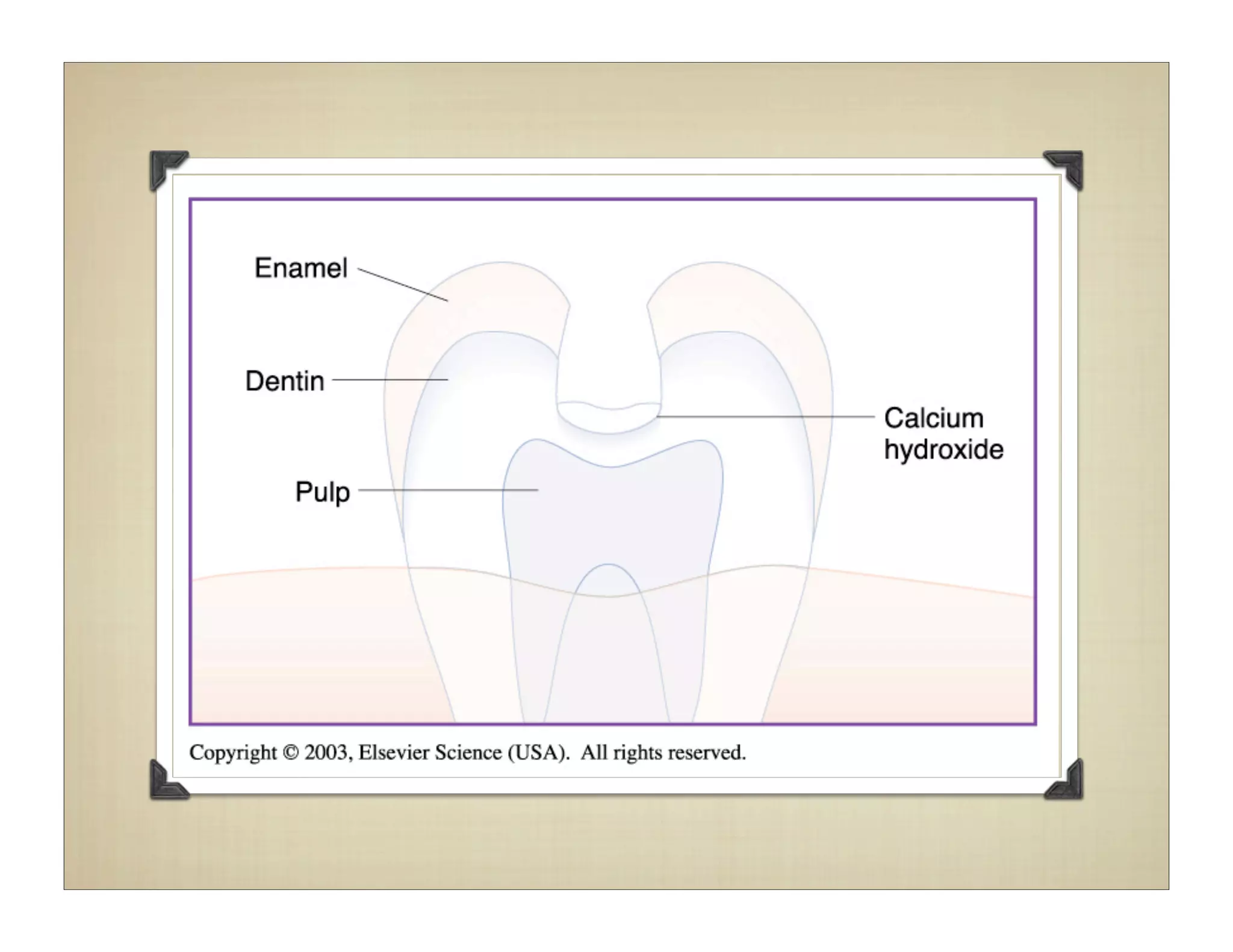 Dental bases and liners | PDF