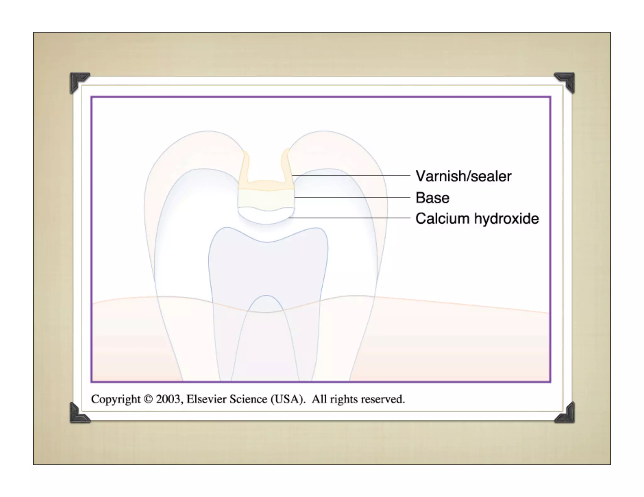 Dental bases and liners | PDF | Dental Health | Diseases and Conditions