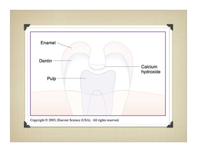 Dental bases and liners | PDF | Dental Health | Diseases and Conditions