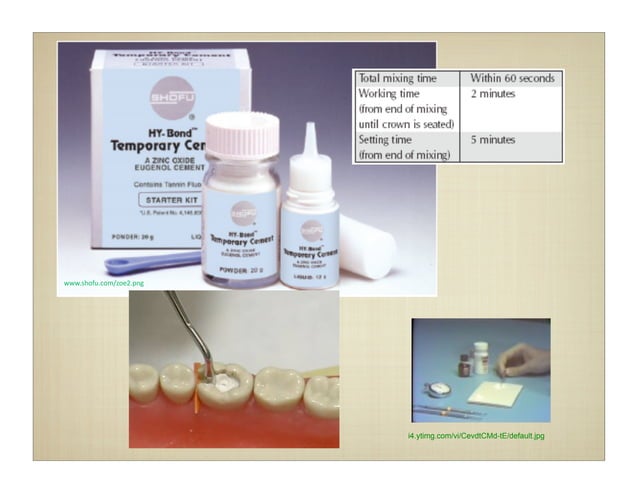 Dental bases and liners | PDF | Dental Health | Diseases and Conditions