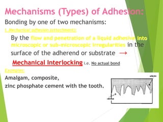 Dental bonding.ppt