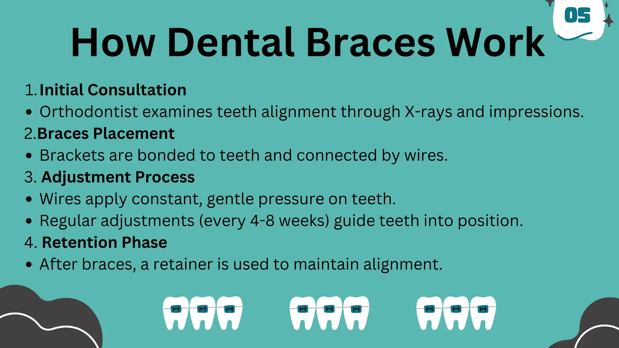 Dental Braces: In-Depth Overview How to Care | PDF