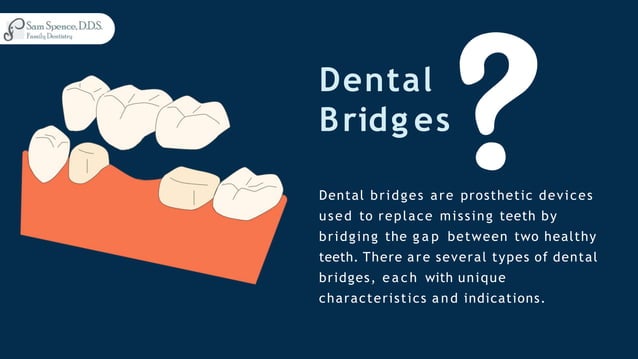 Dental Bridges And It's Types Explained Simply | PPTX