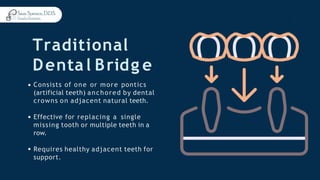 Dental Bridges And It's Types Explained Simply | PPTX
