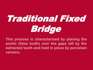 Dental bridges defined | PDF | Dental Health | Diseases and Conditions