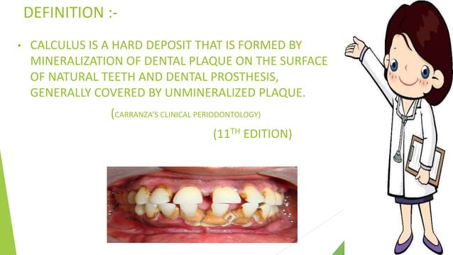 Dental calculus | PPTX | Dental Health | Diseases and Conditions