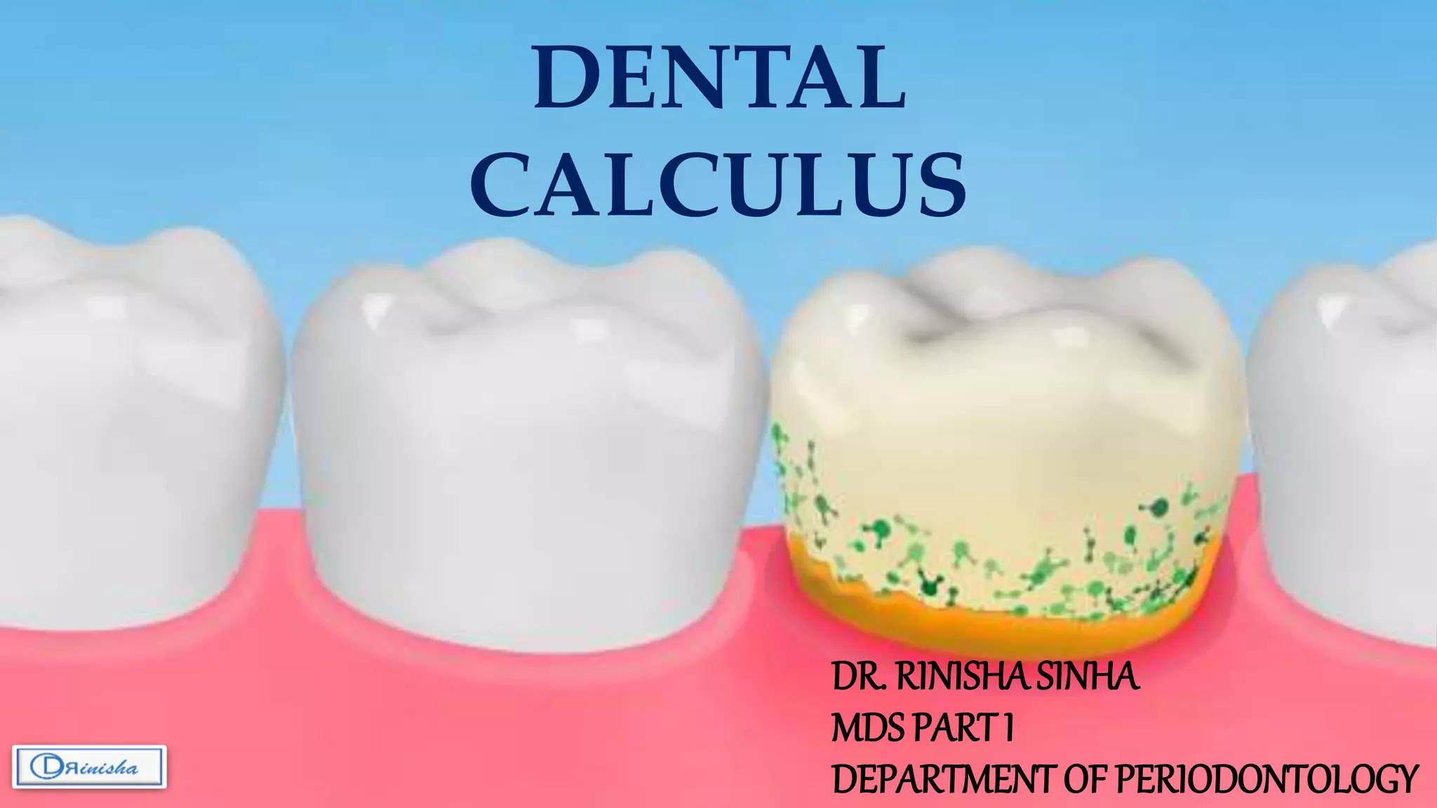 Dental calculus | PPTX