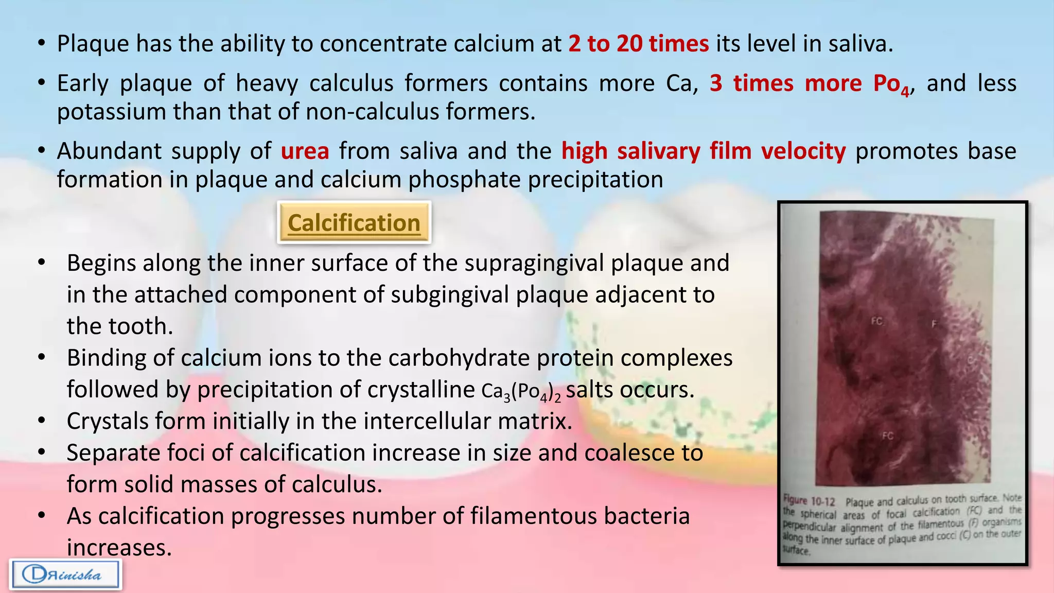 Dental calculus | PPTX