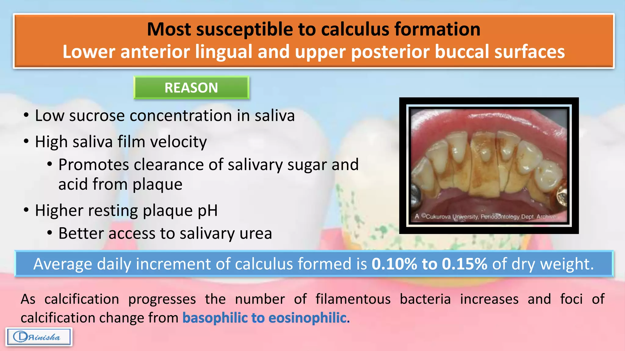 Dental calculus | PPTX