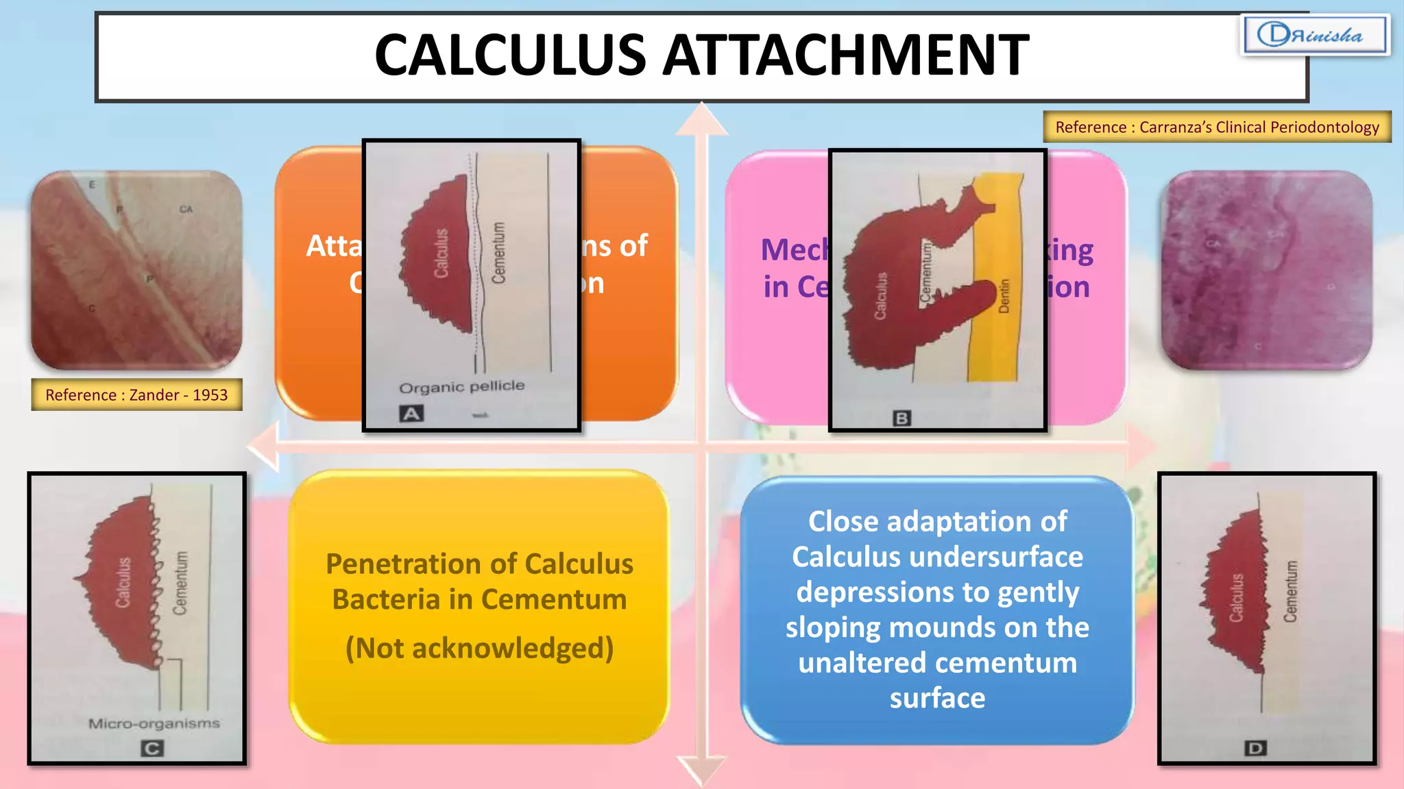 Dental calculus | PPTX