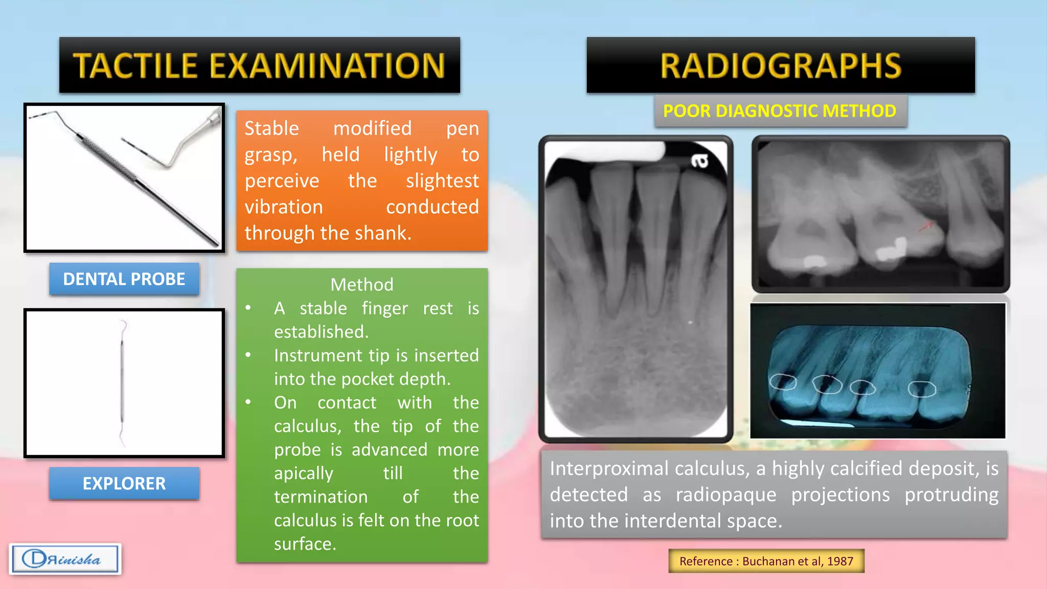 Dental calculus | PPTX