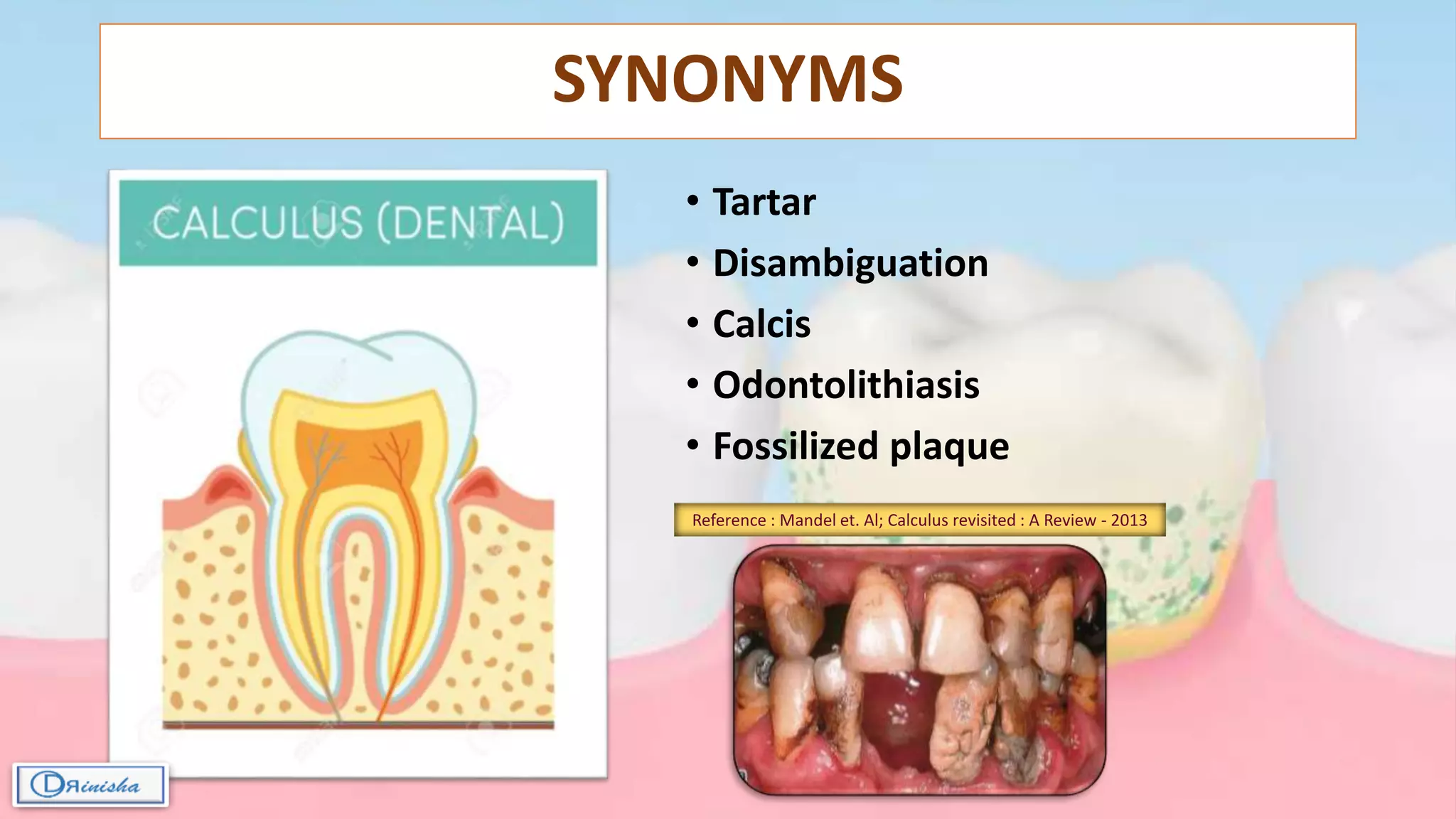Dental calculus | PPTX