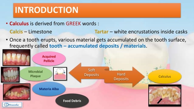 Dental calculus | PPTX | Dental Health | Diseases and Conditions