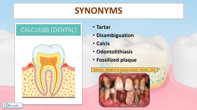 Dental calculus | PPTX | Dental Health | Diseases and Conditions