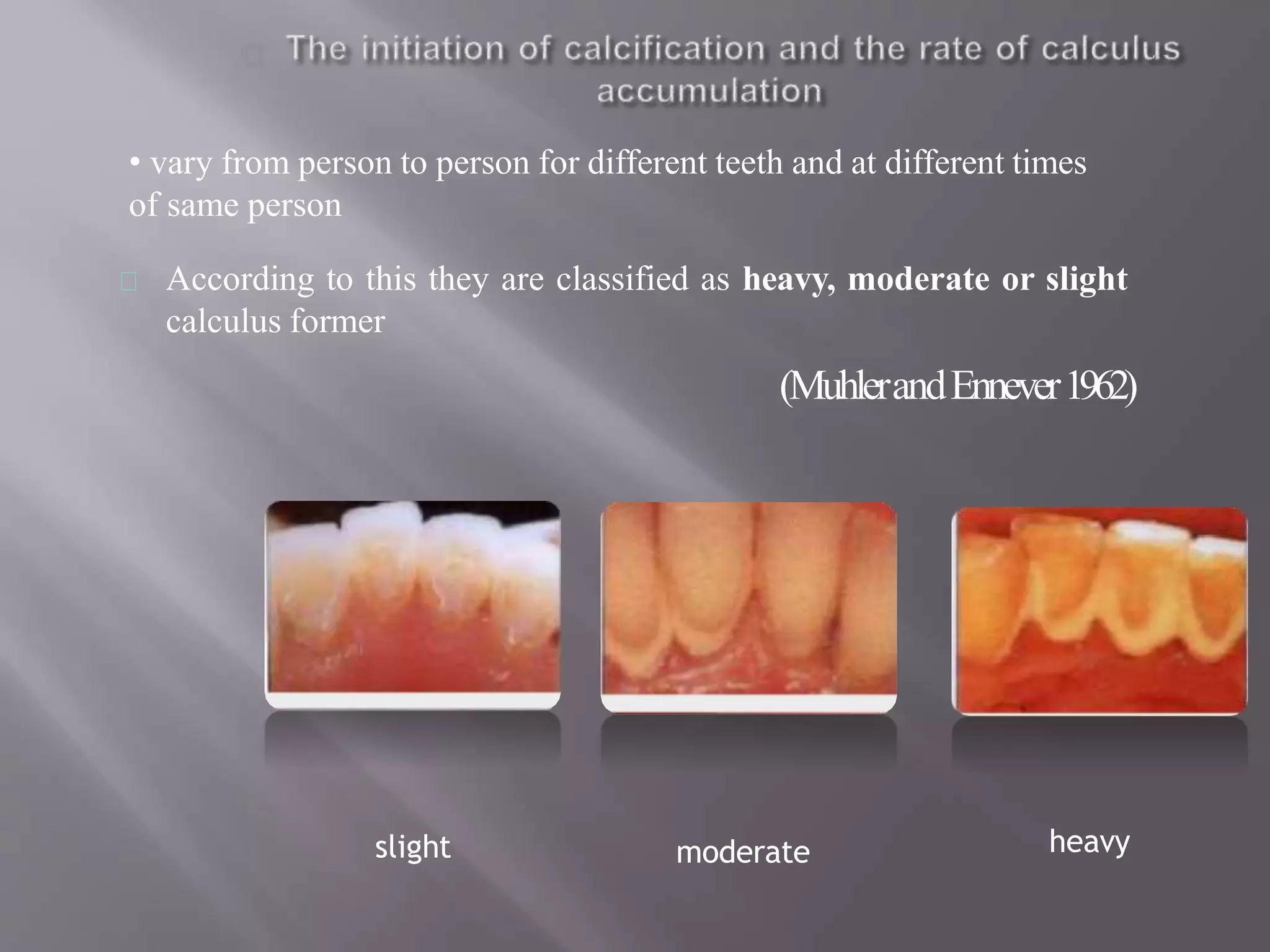 Dental calculus | PPTX | Dental Health | Diseases and Conditions