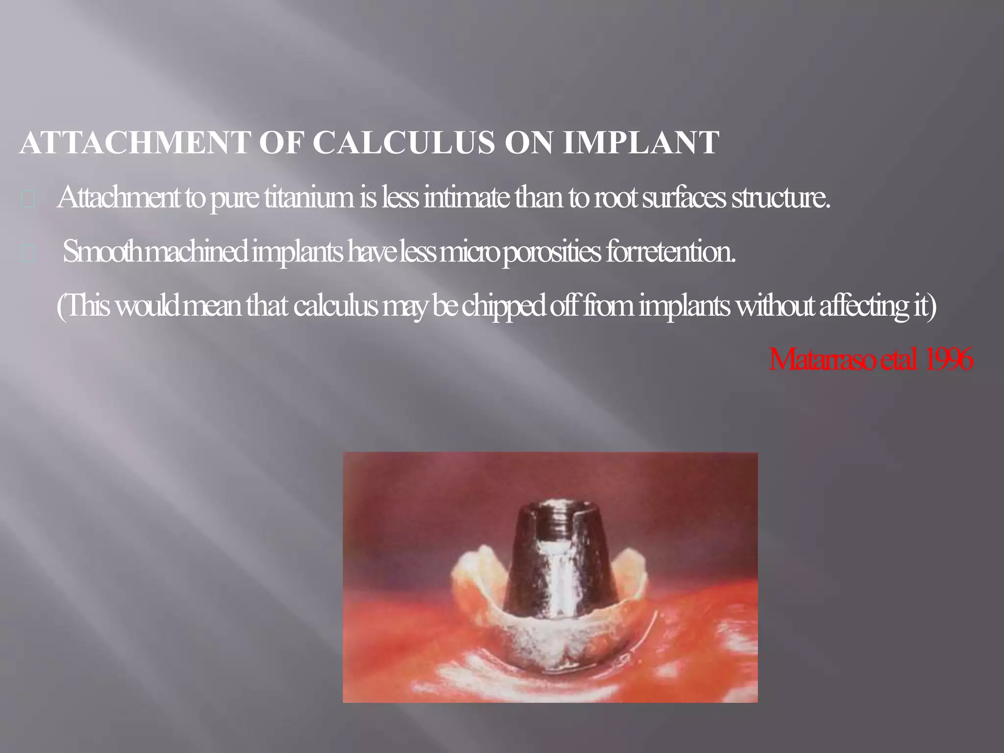 Dental calculus | PPTX