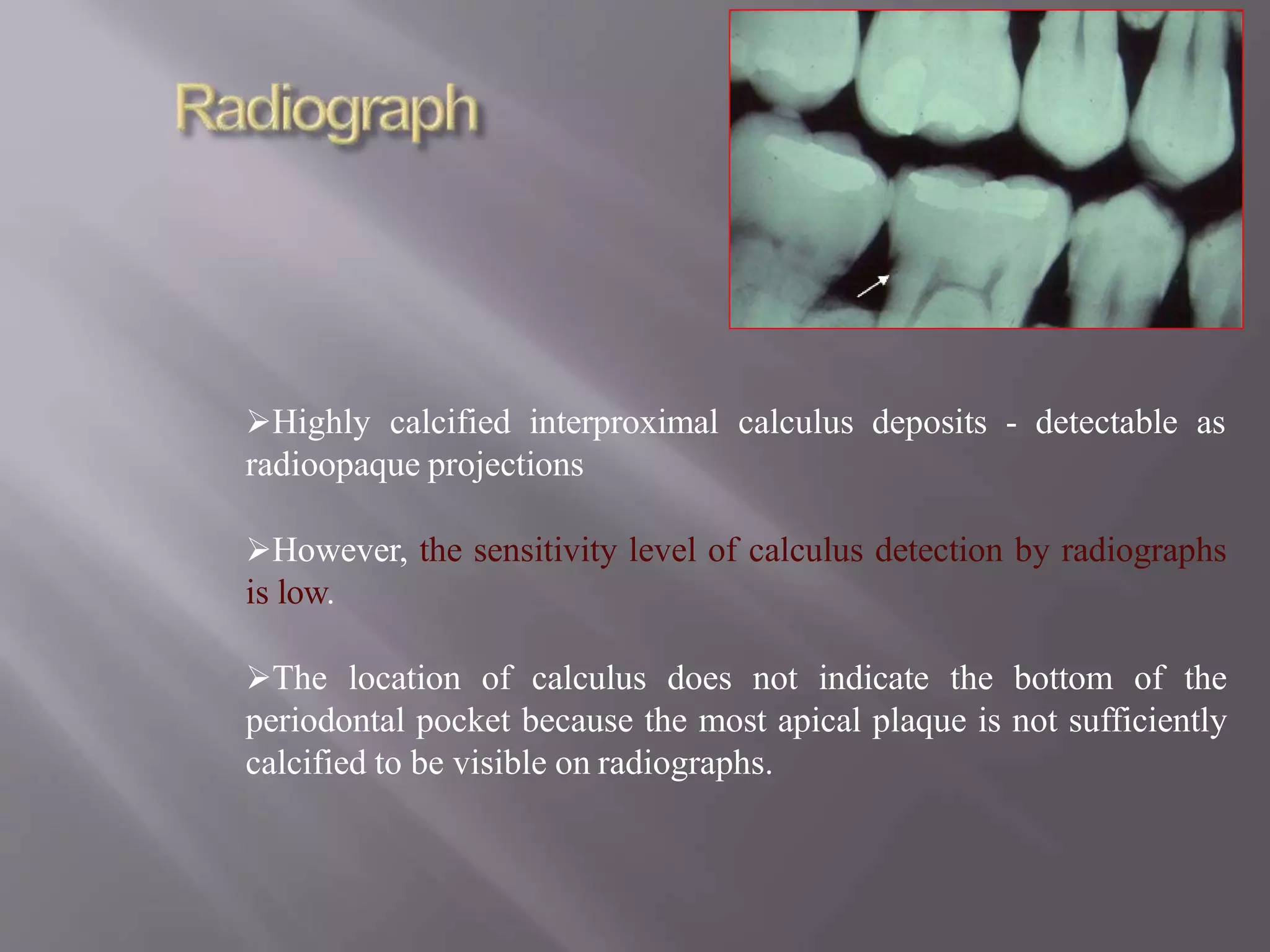 Dental calculus | PPTX