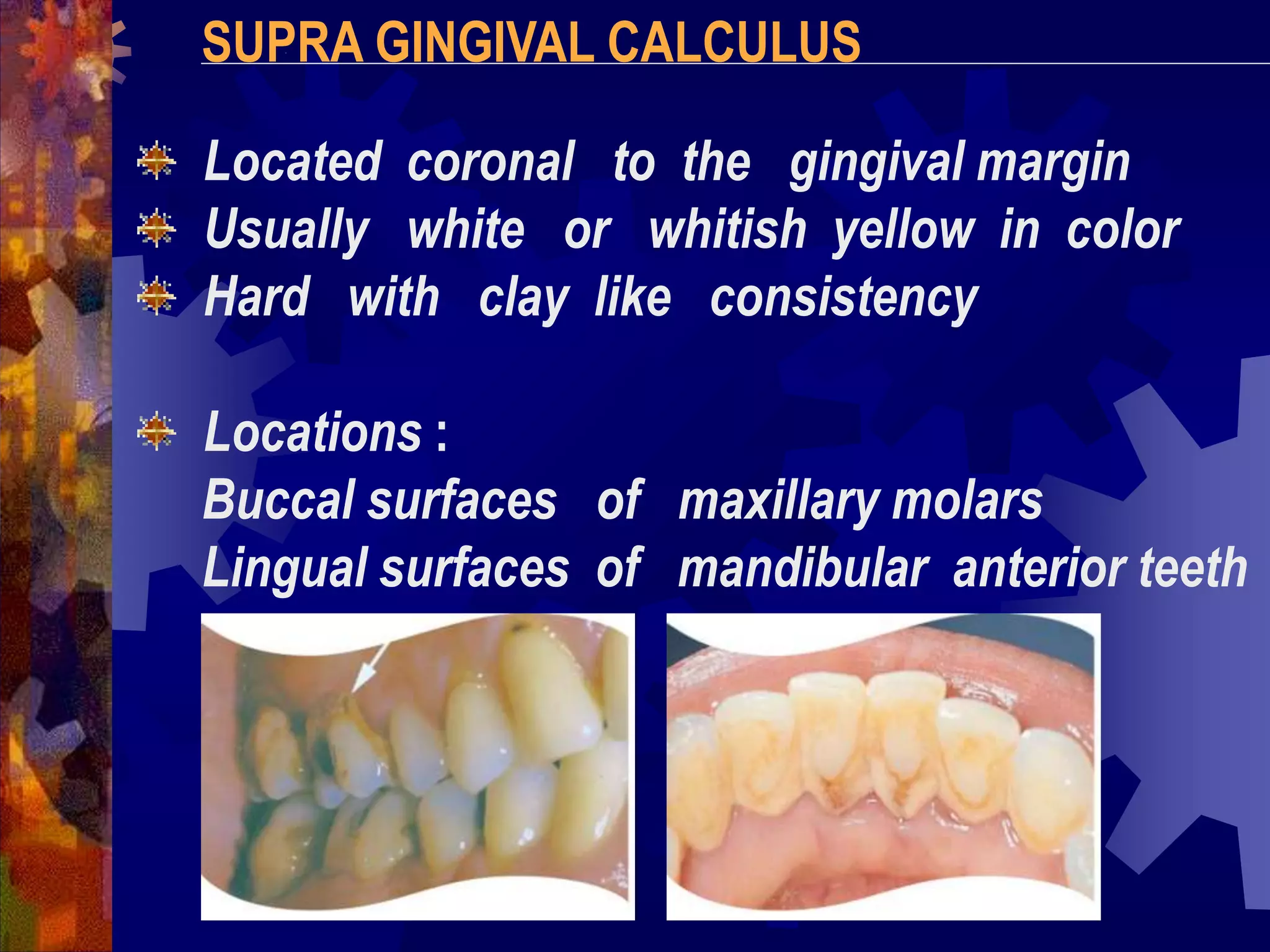 DENTAL CALCULUS.ppt