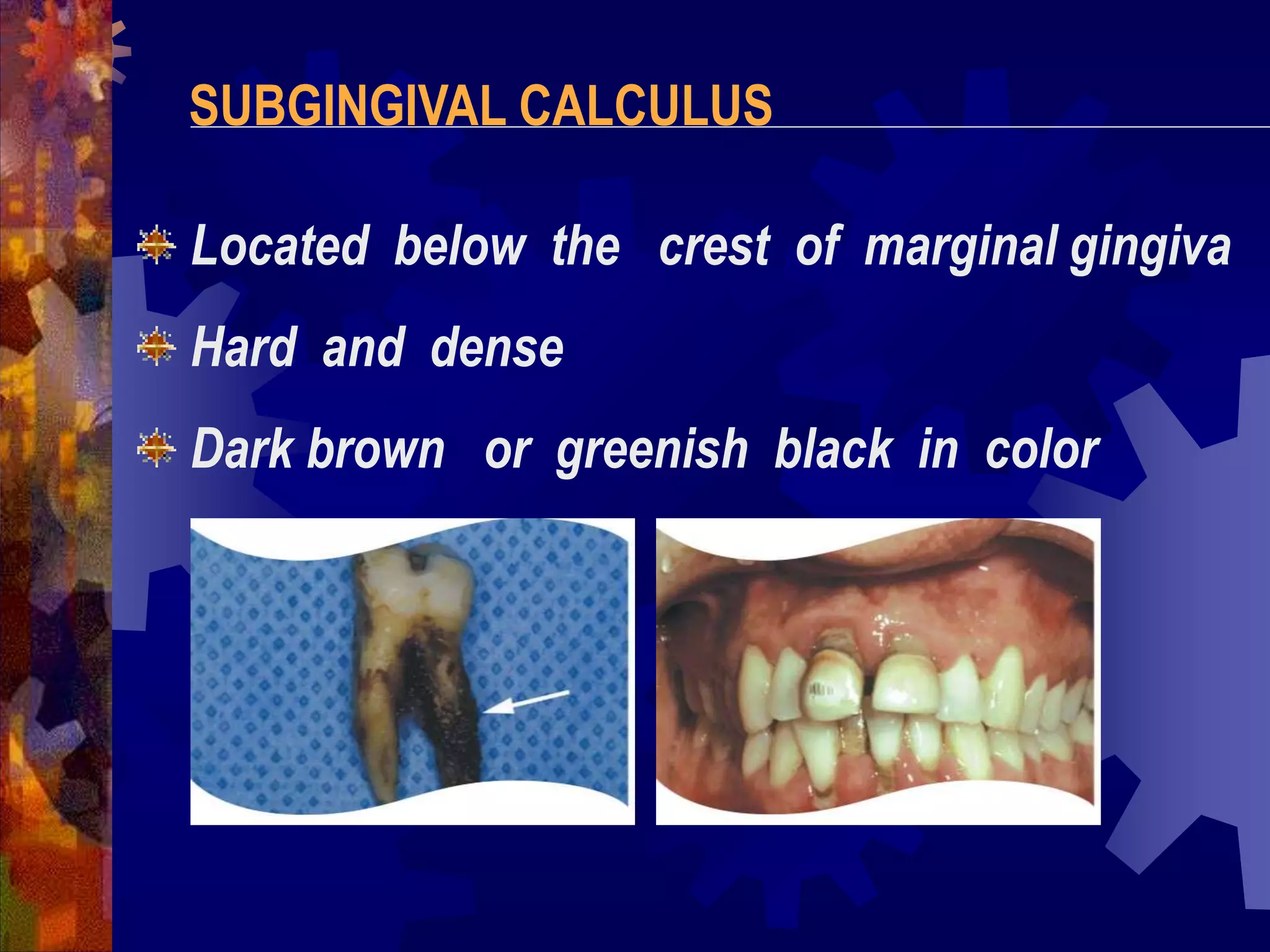 DENTAL CALCULUS.ppt