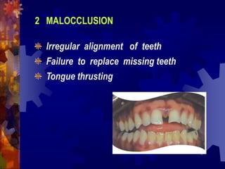 DENTAL CALCULUS.ppt