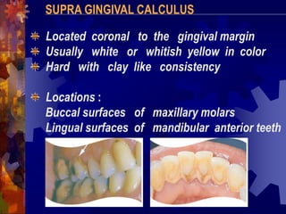 DENTAL CALCULUS.ppt