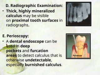 Dental Calculus - Formation, Pathogenesis and Removal | PPT