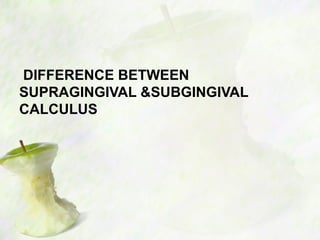 Dental Calculus - Formation, Pathogenesis and Removal | PPTX