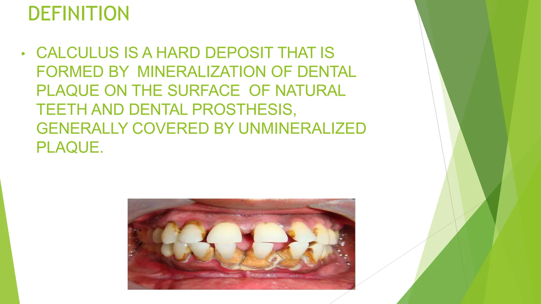 dentalcalculus_171228133124_converted (1).pptx