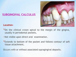 Subgingival Calculus