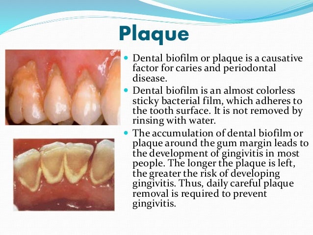 Oral Health and Dental Management