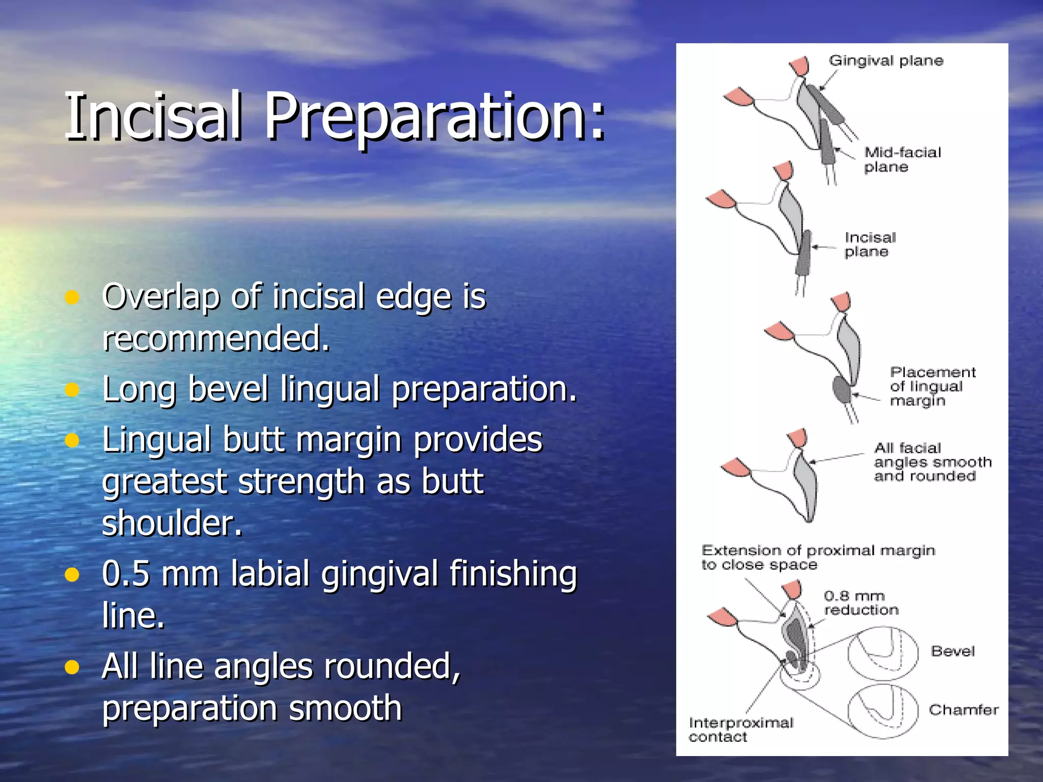 Dental caps | PPT